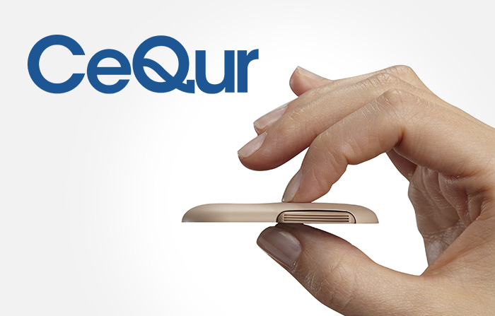 CeQur acquires J&J’s Calibra Finesse wearable insulin patch