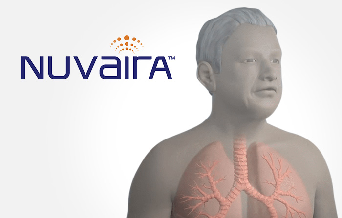 Nuvaira attains $79m financing for innovative COPD treatment